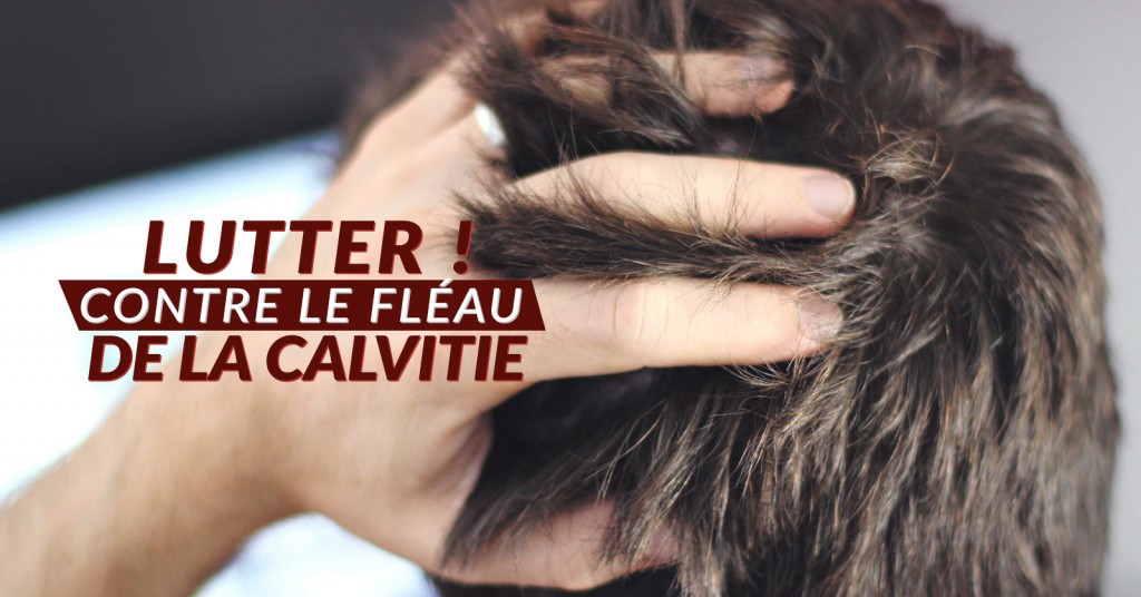 Lutter contre calvitie - Barbichette.fr